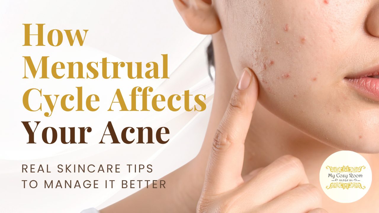 How the Menstrual Cycle Affects Acne and How to Manage It Better - My ...